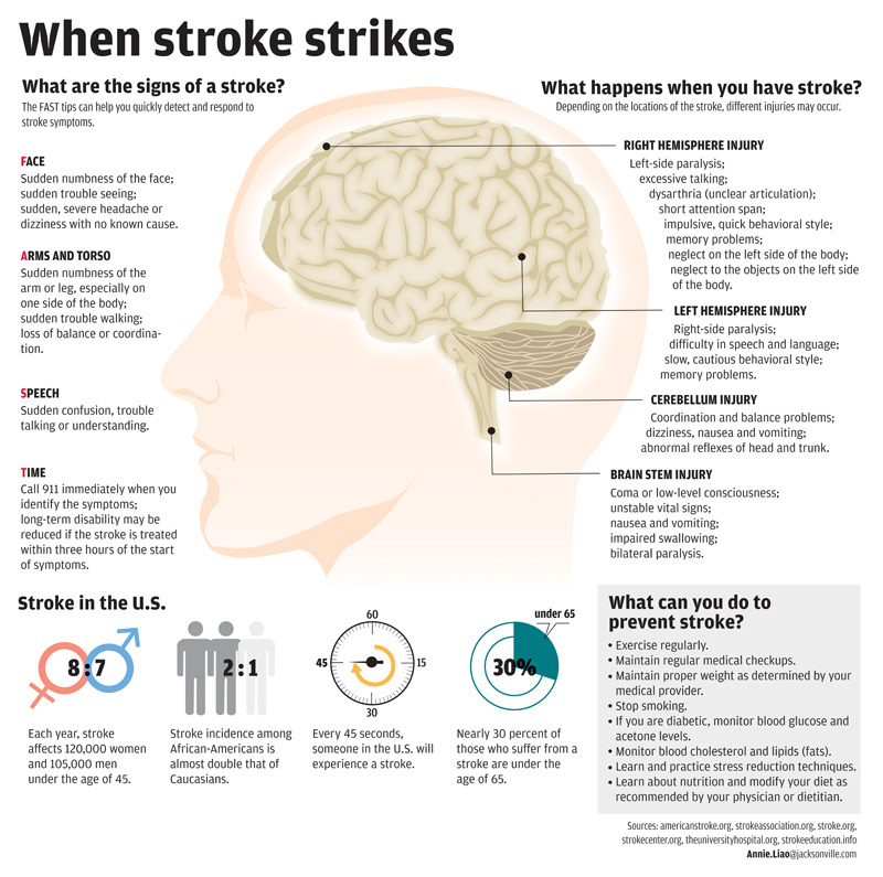 Annie Liao Visual Land: To infographics and beyond! - When stroke strikes
